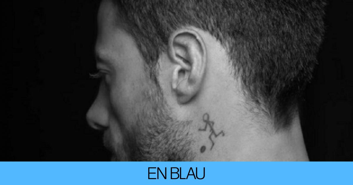 Así ha quedado famoso de T5: se quedaba calvo, le han trasplantado ...