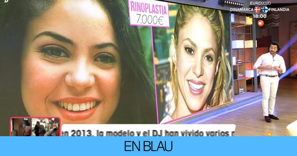 Shakira, su antes y después con cirugía estética: 65 mil euros según ...
