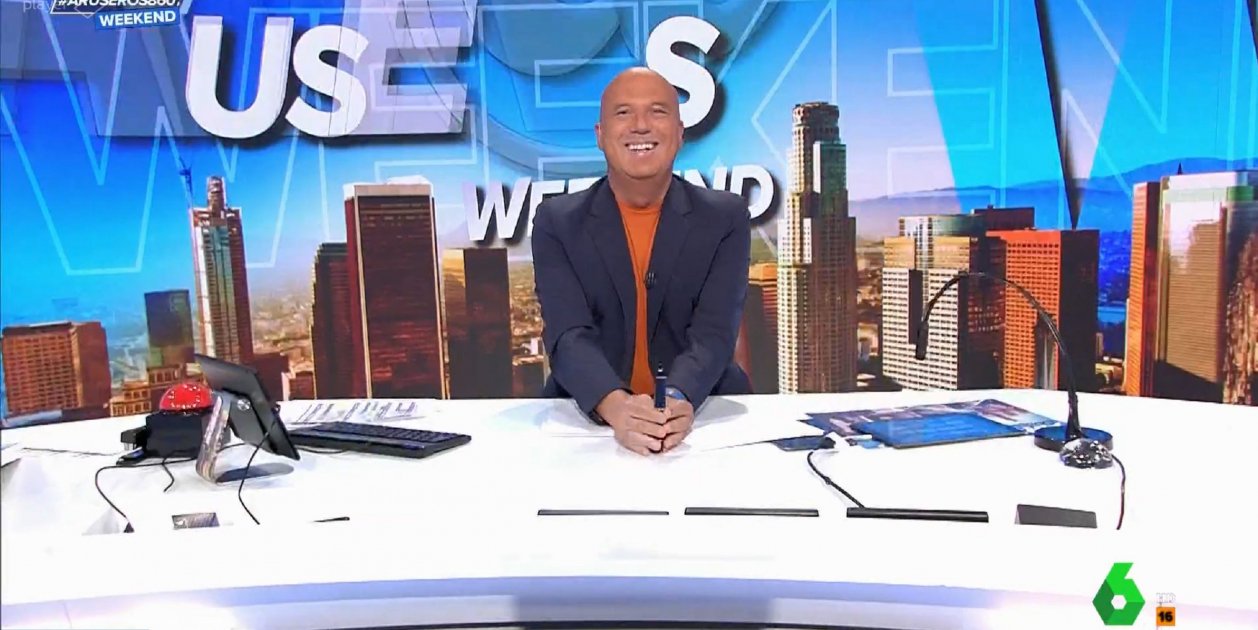 Alfonso Arús llevaba peluca, convfiesa qué producto usaba para no ser ...