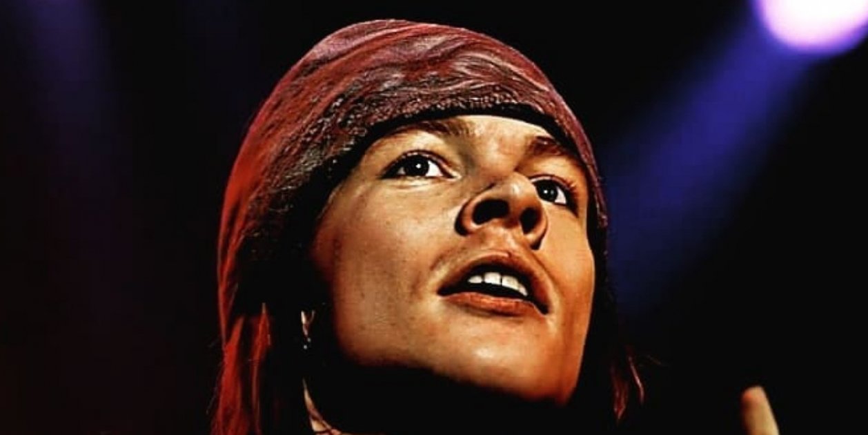 Axl Rose deja en shock: irreconocible, hinchado, injerto naranja, hiere ...