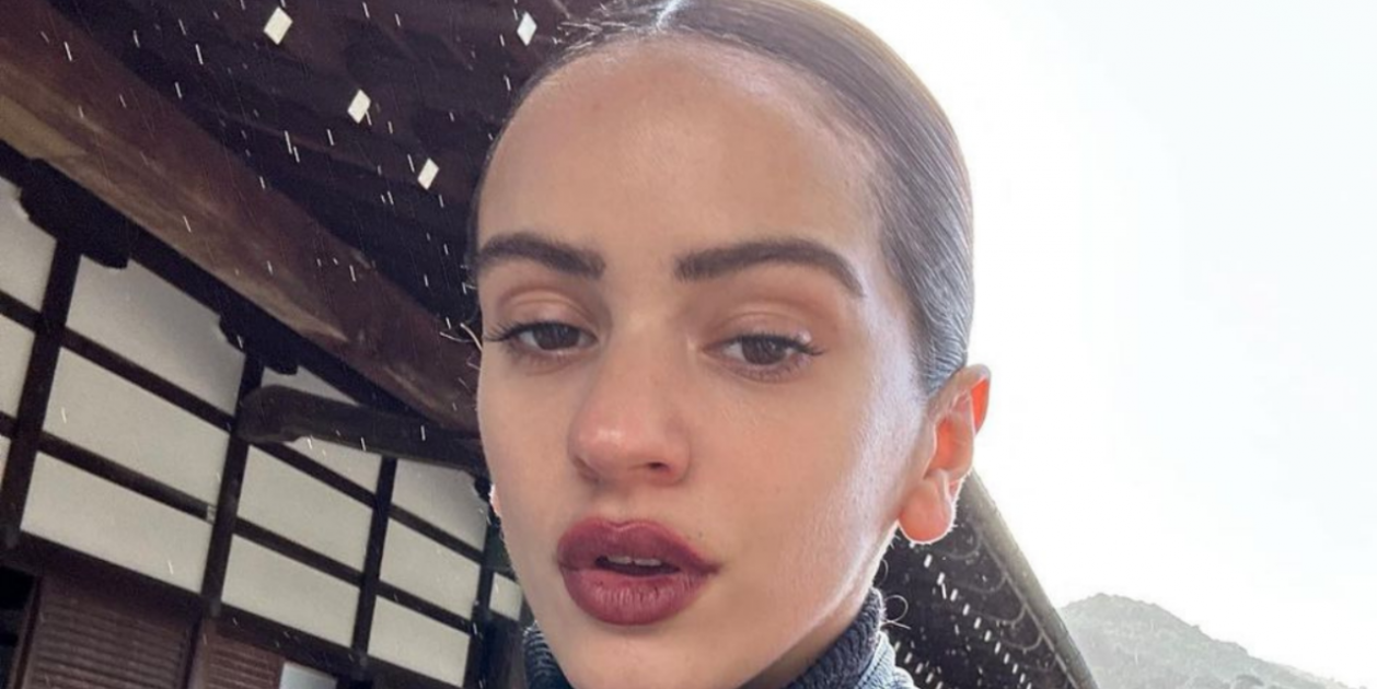 Impacto brutal al ver los nuevos labios de Rosalía: "Te has pasado con ...