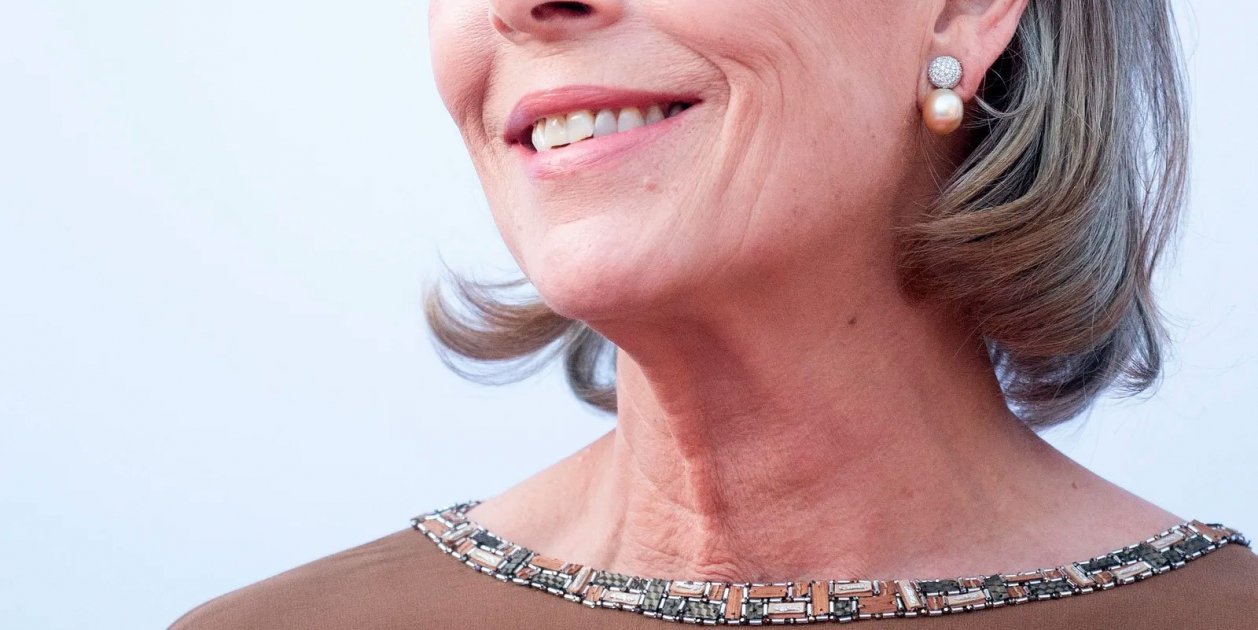 Carolina de Mónaco, envejecer sin bótox ni ácido hialurónico, cara al ...
