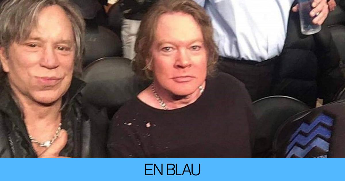 Dues estrelles mundials, irreconeixibles per la cirurgia i el bòtox