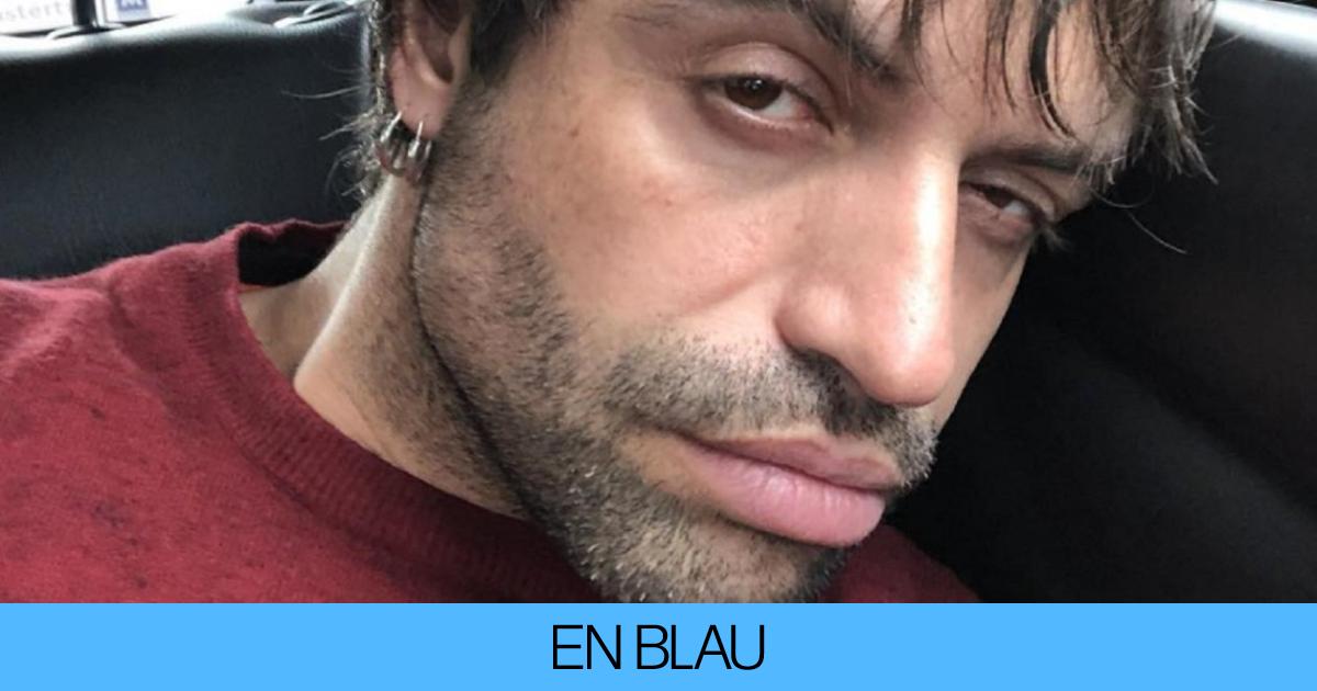 Manu Guix sorprende a los fans revelando que le han tenido que operar