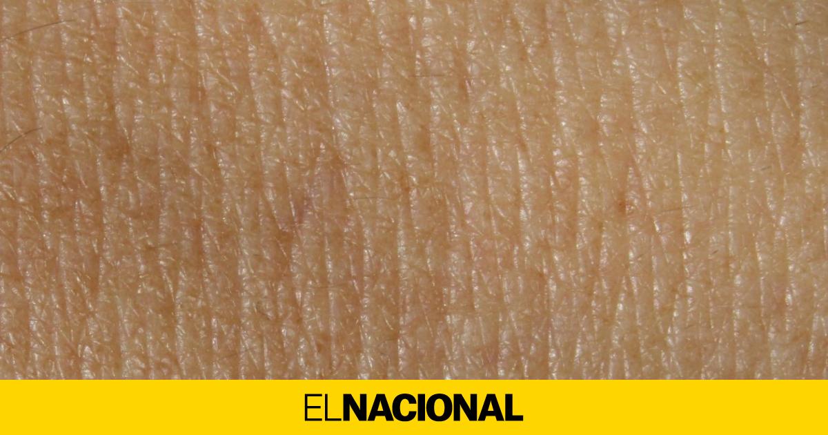 Cinco síntomas de que tu piel puede estar “estresada”