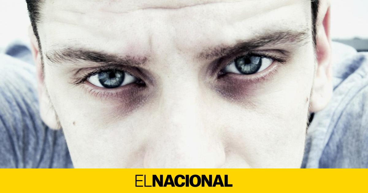 6 causas que pueden provocar las ojeras