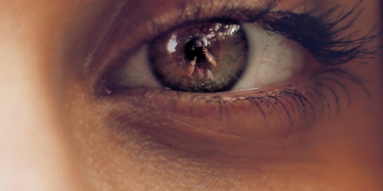 Lo que necesitas saber sobre las ojeras