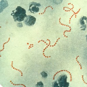 Madrid confirma dos menores muertos y 14 casos más por estreptococo A