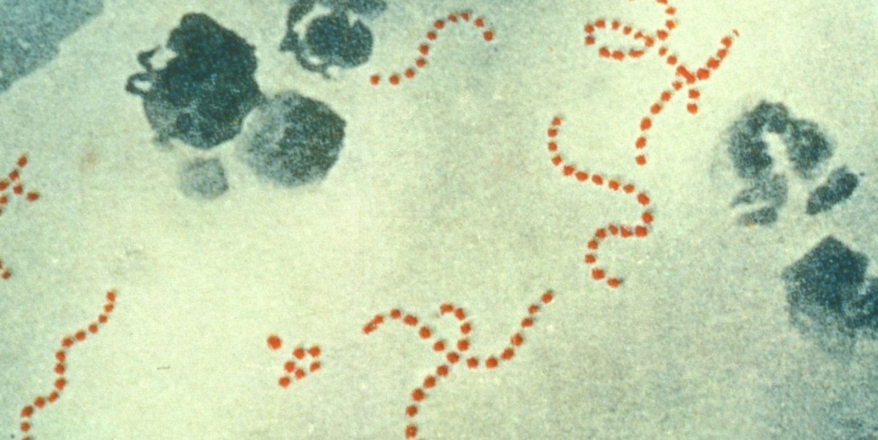 Madrid confirma dos menores muertos y 14 casos más por estreptococo A