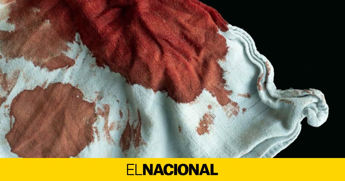 Ahora sí: el método 100% efectivo para limpiar las manchas de sangre en ...