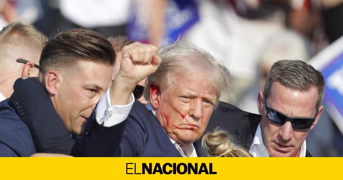 Donald Trump confirma en una entrevista que le falta un trozo de la ...
