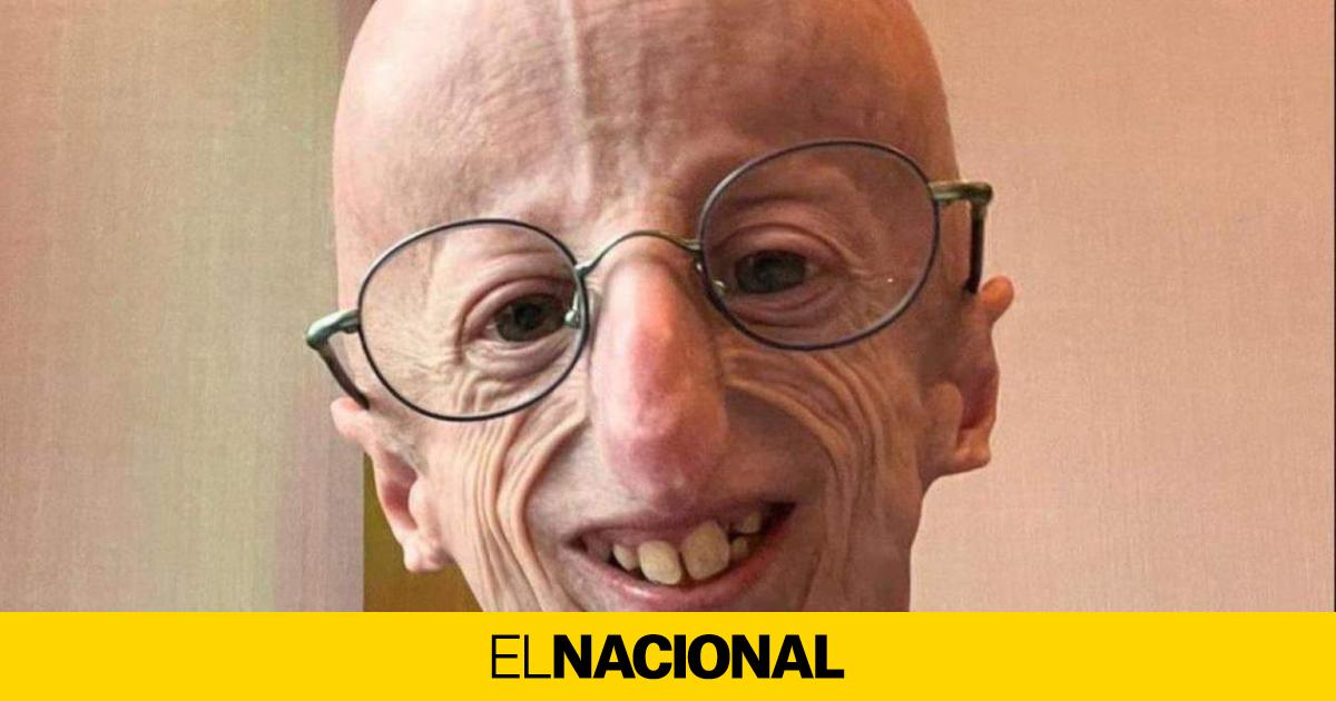 Muere Sammy Basso, el científico italiano que visibilizó la progeria, a ...